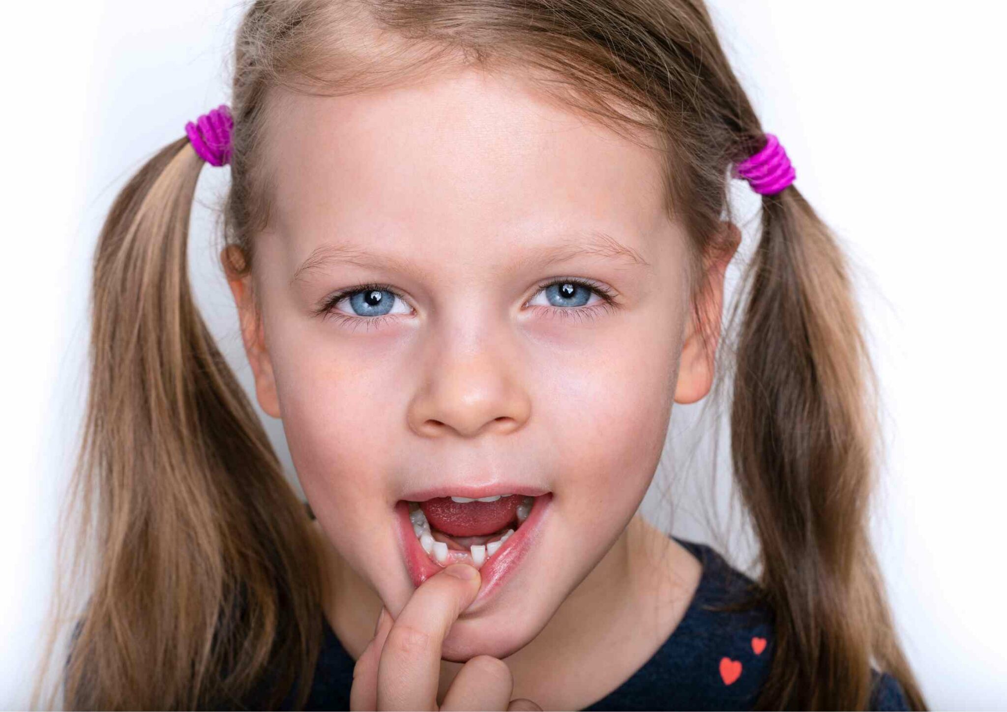 Adults with Baby Teeth: Causes & Treatment Options