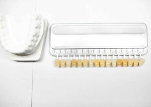 Veneers: Weighing the Pros and Cons for a Perfect Smile