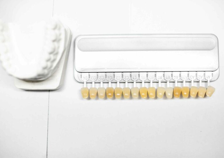 Veneers: Weighing the Pros and Cons for a Perfect Smile