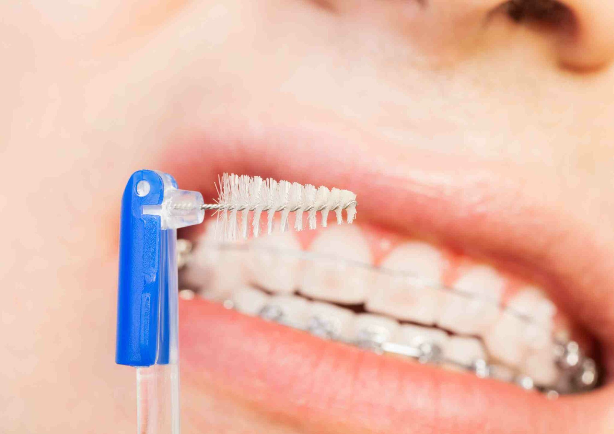 Best Floss for Bleeding Gums: The Best Options