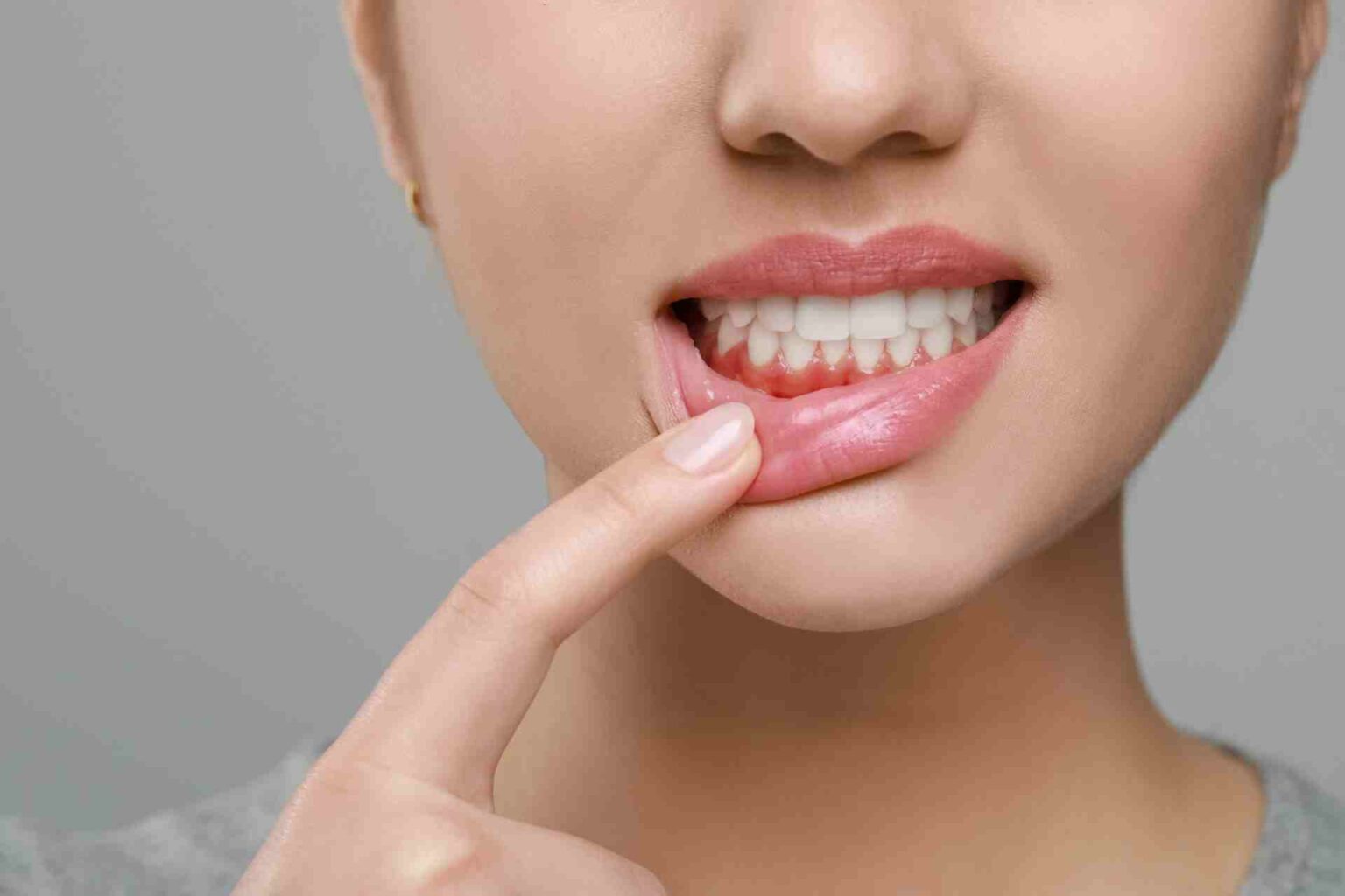 Gingivitis Treatment: How To Get Rid of Gingivitis?