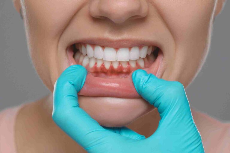 Causes and Concerns of Spitting Blood Without Coughing