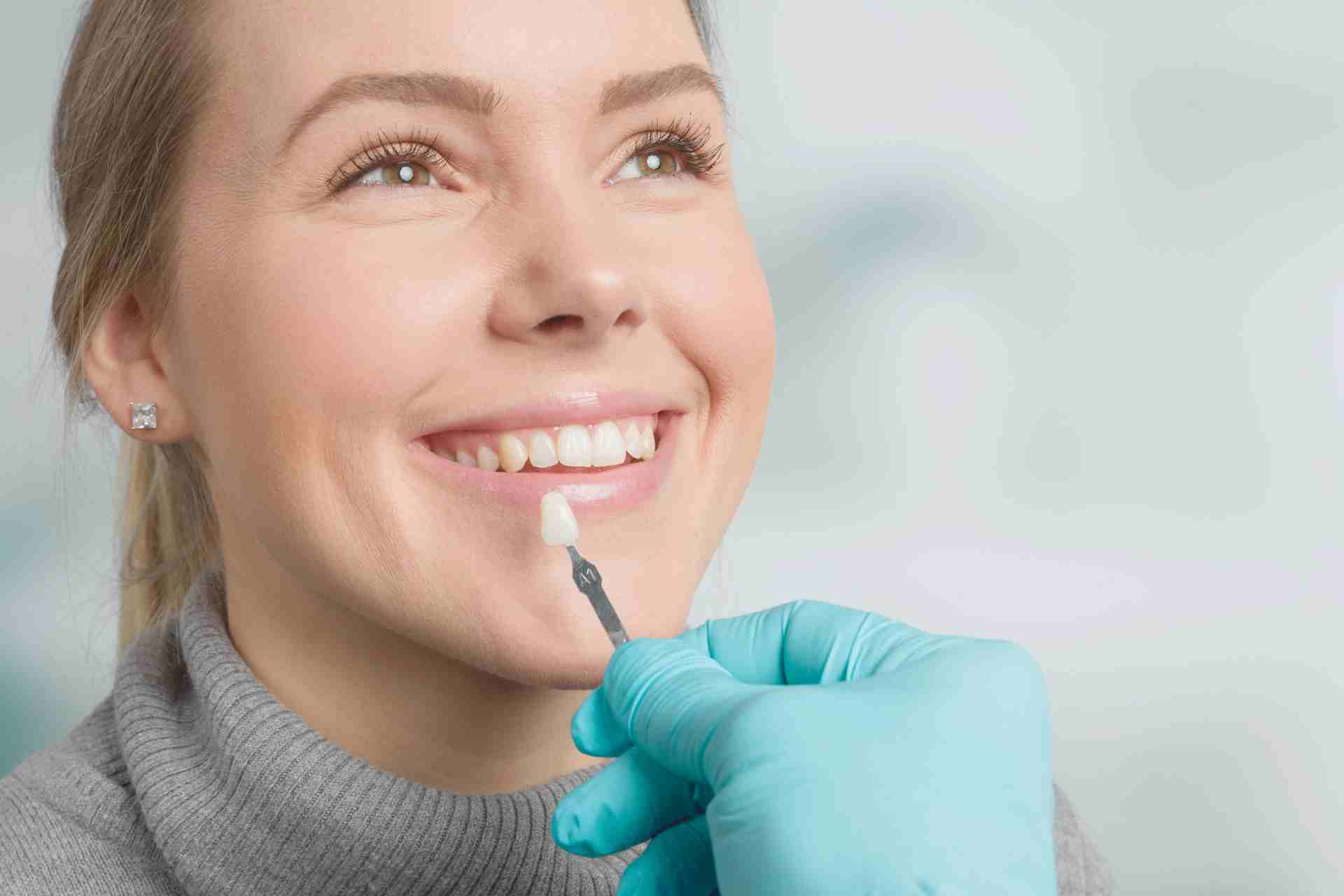 What Happens to Teeth Under Veneers?