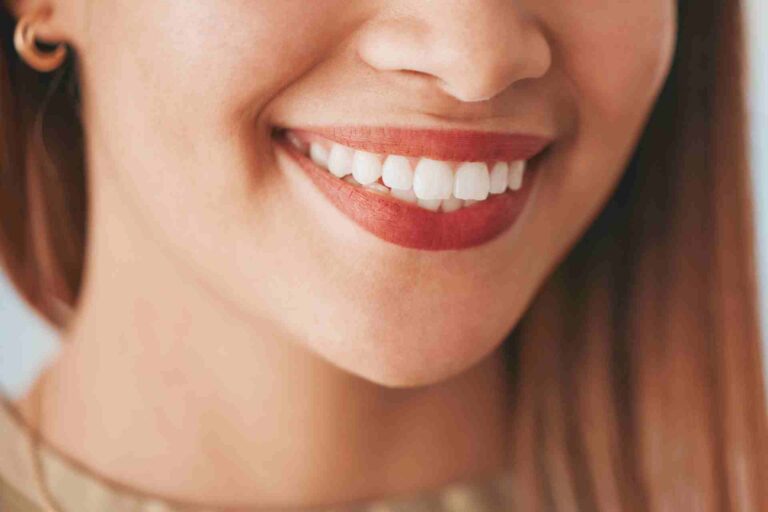 How Do Veneers Work? | Joyce The Dentist Explains