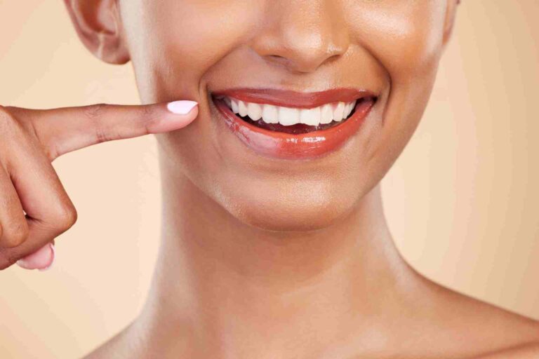 What are Craze Lines? Causes, Prevention and Treatments