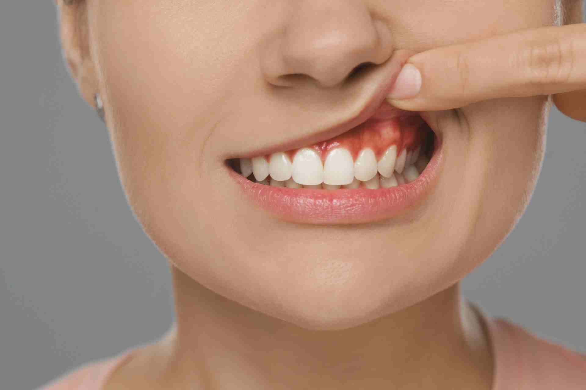 Why Is My Gum Swollen Around One Tooth in the Back?