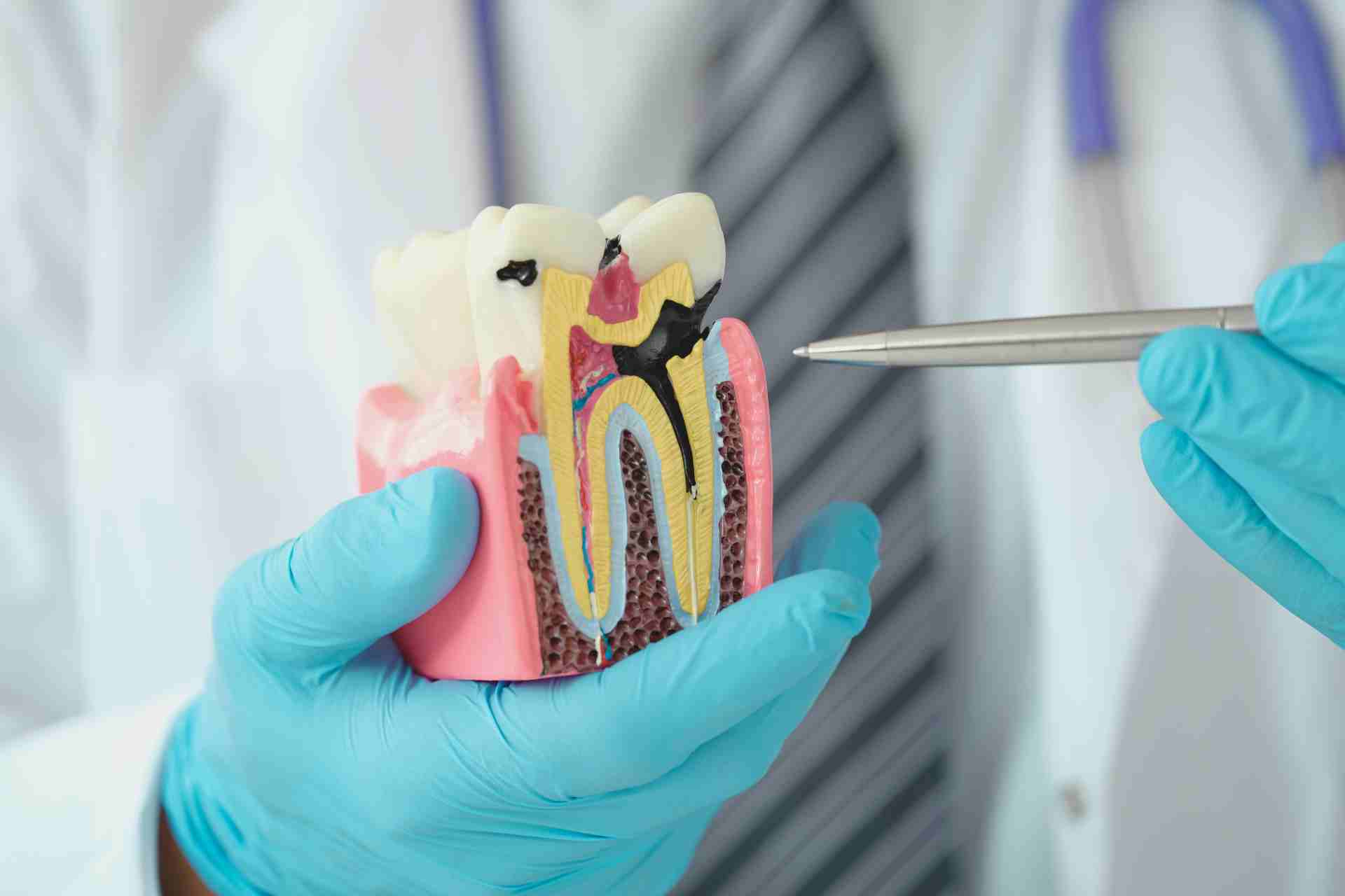 Why Do My Teeth Hurt When I Eat Sweets?