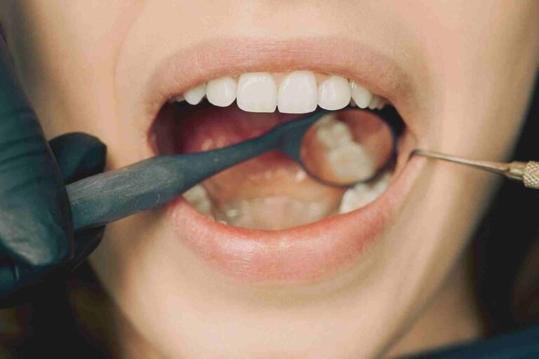 Teeth Names Explained: Types, Functions, and FAQs