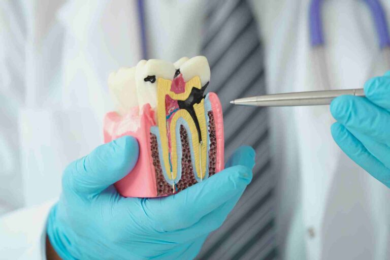 Front Tooth Cavity: Causes, Treatment, and Prevention