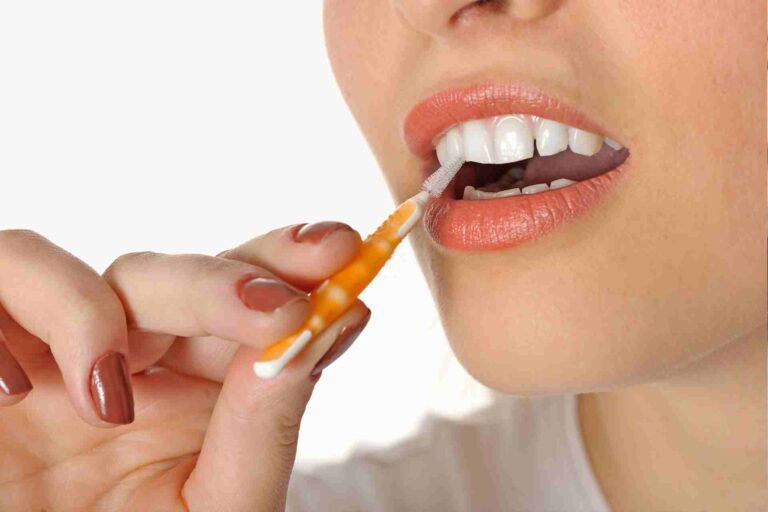 How to Floss with a Permanent Retainer: A Complete Guide