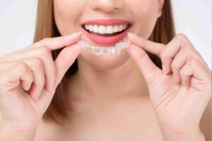 What Is an Edge-to-Edge Bite and Why Does It Matter?