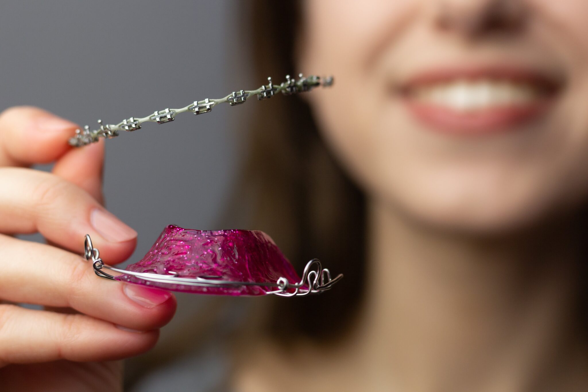 Power Chain Braces Explained: Everything You Need to Know