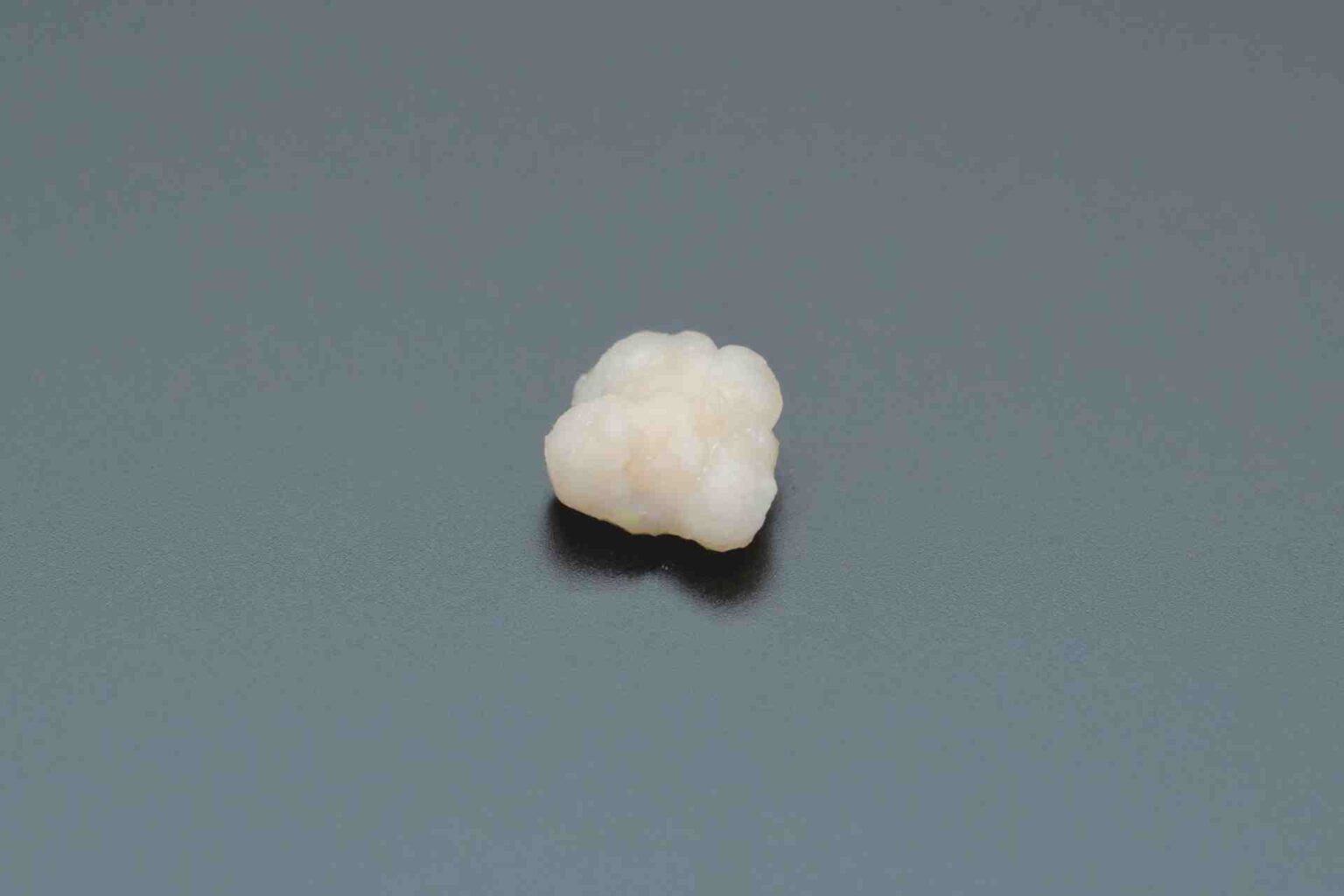 Tonsil Stones Smell: Causes, Removal, and Prevention