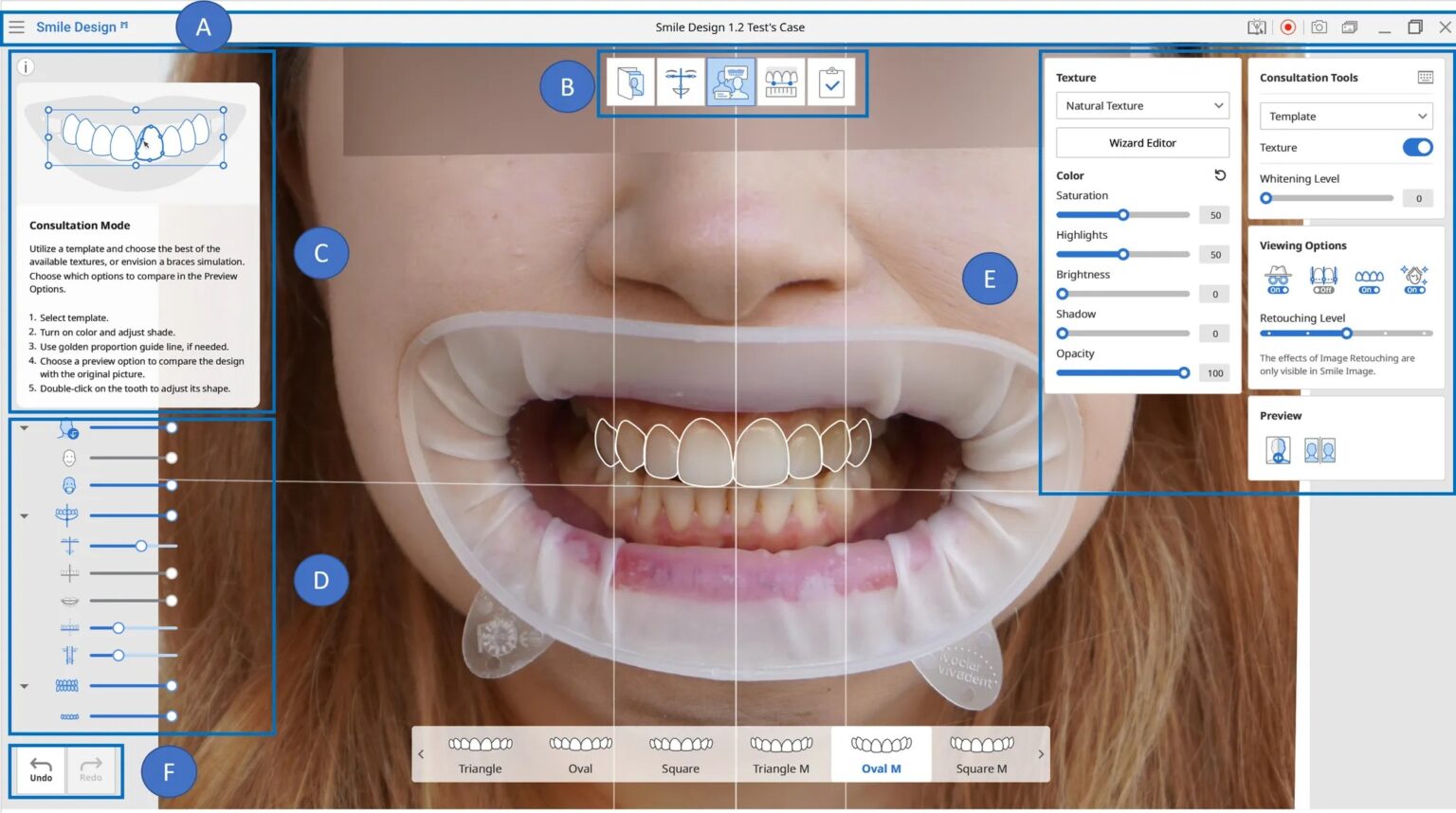 Best Smile Simulation Software for Dentists (2026)